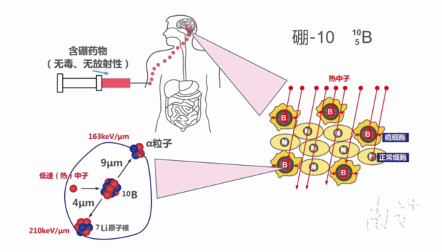 用硼中子精准“狙击”癌细胞，癌症“第五疗法”突围｜重器风华_南方+_南方plus