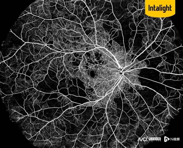 引领全球OCT发展，Intalight赛炜“出海即巅峰”_南方+_南方plus